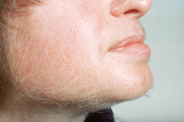 What stage is peach fuzz? – Growing Up in the Lord for Boys